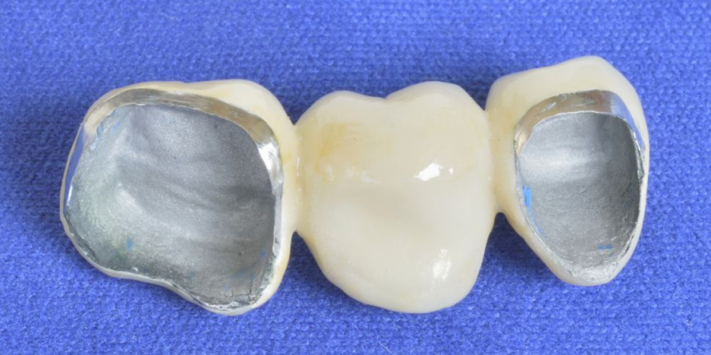 Opolis Dental Care – Spreading Smiles